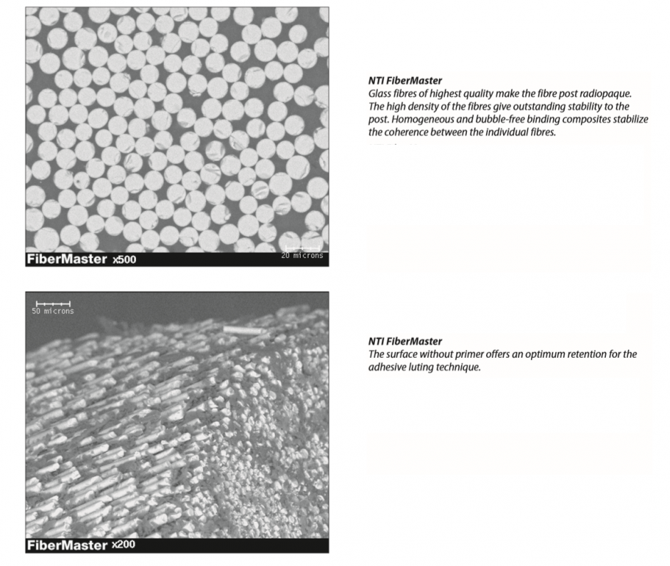 Root post Restoration Systems | Premiere Dental Sdn Bhd | Malaysia